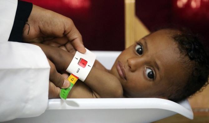 540 000 enfants «affamés» au Yémen, selon l’Unicef | Arab News FR